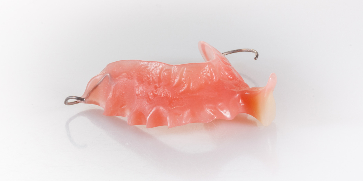 interimsprothese-head - Zahnwerkstatt